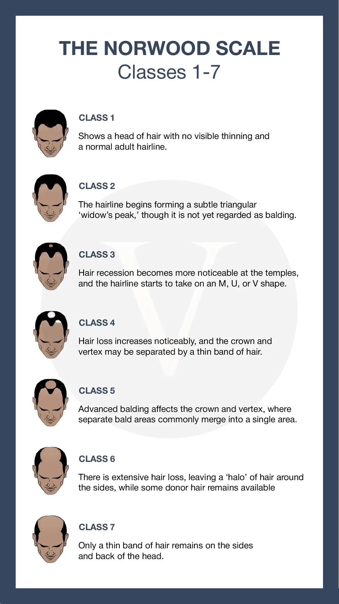 Norwood Hamilton Scale: Hair Loss Stages 1–7 & Hairline